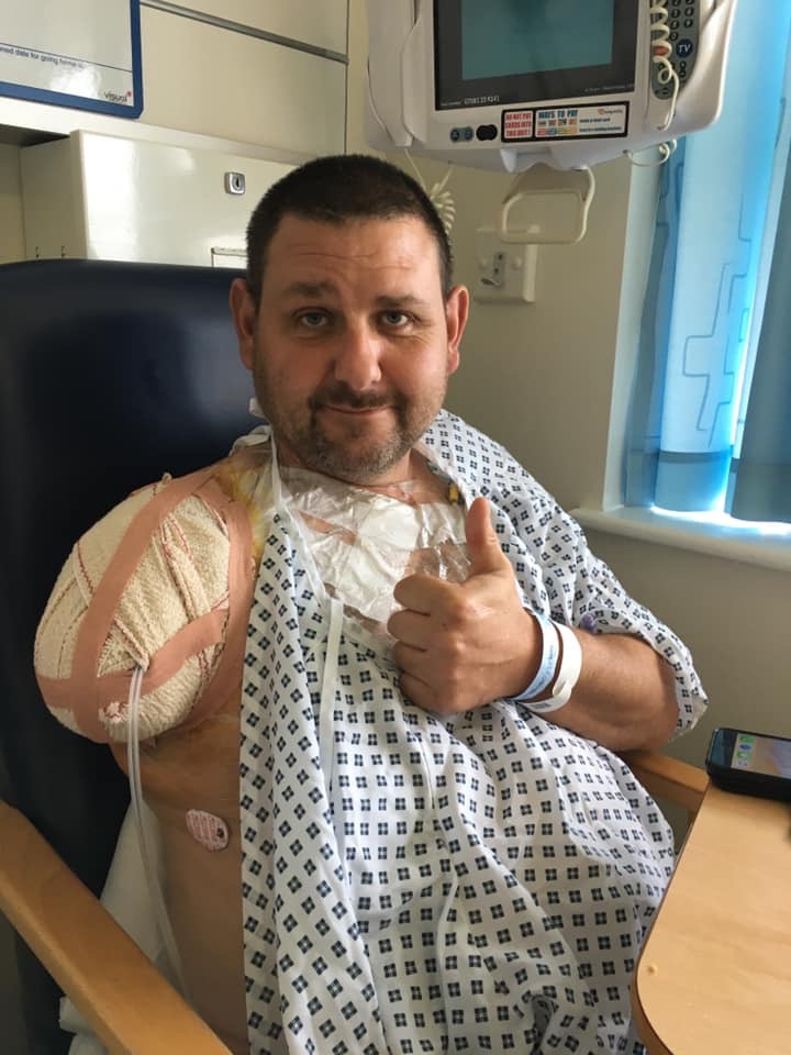 Fund-raising to buy farmer a prosthetic arm tops nearly £25,000 - The ...